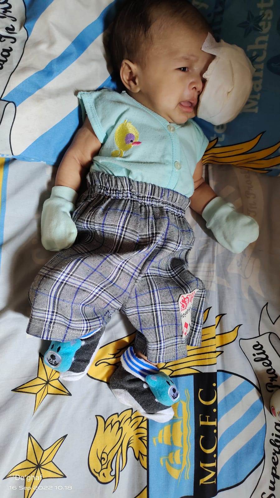 Campaign - Selamatkan harapan dan penglihatan Ghafi | Forhumanity.id