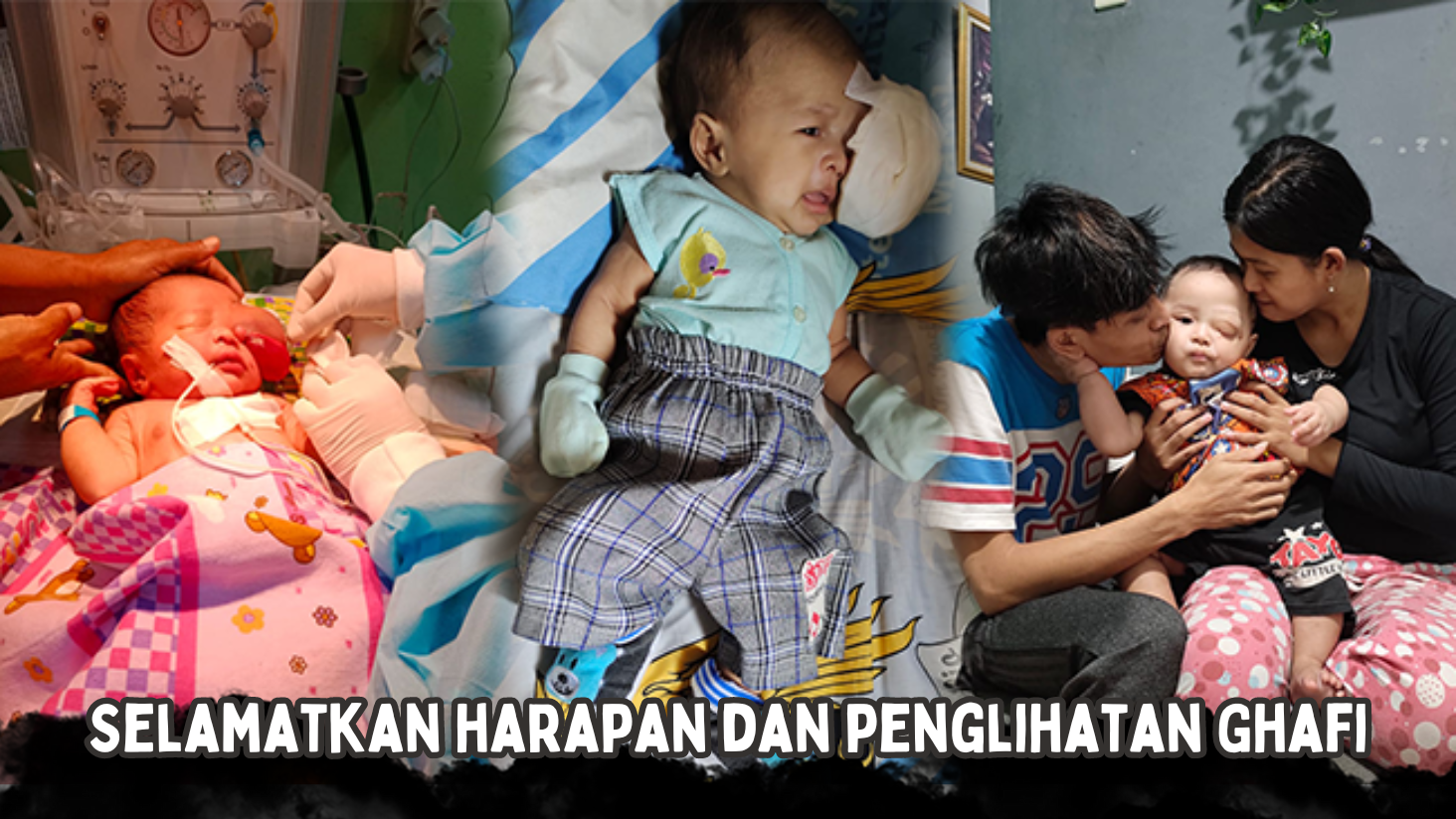 Campaign - Selamatkan harapan dan penglihatan Ghafi | Forhumanity.id