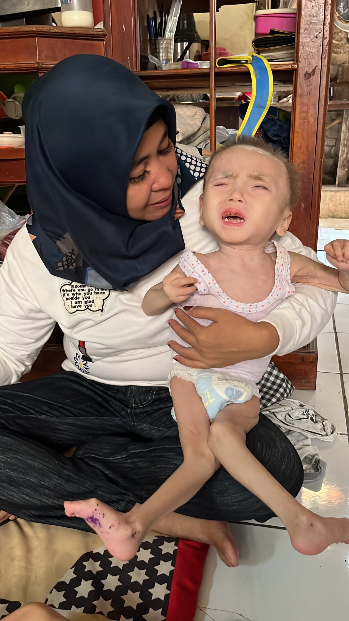 Campaign - Bantu kakak beradik alkha dan akhtar sembuh | Forhumanity.id